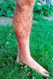 Wild Parsnip | EEK WI